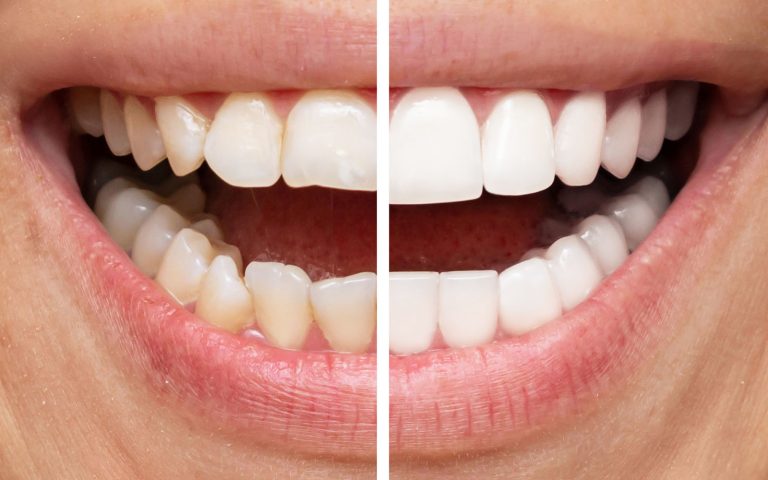 Cosmetics – SMILEWELL Dentistry & Implants